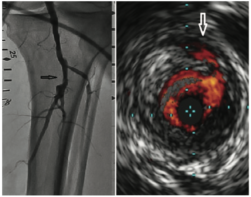 Cath Lab Digest – CathLab.com